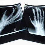 Rx Mano nel S-Medical Group di Sora